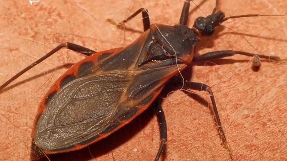 5 things to know about the deadly 'kissing bug' and Chagas disease